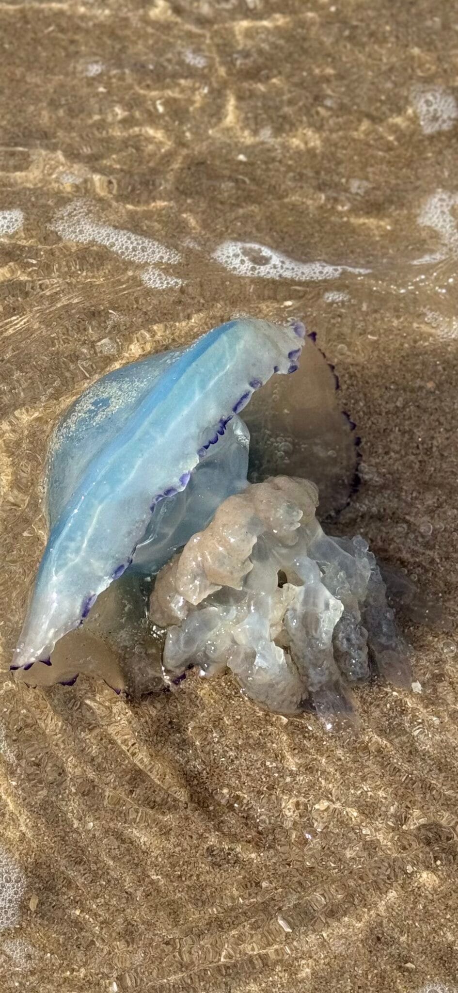 HKW zoekt uit: Wat kun je doen tegen een kwallenbeet?